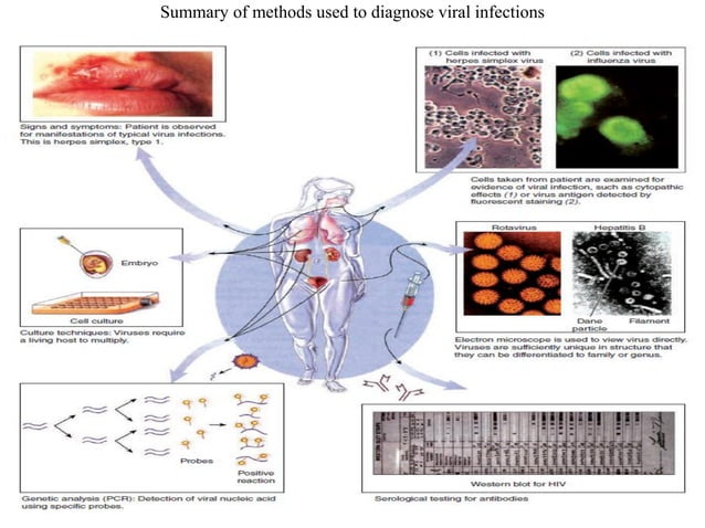 9.-Pathogenesis-and-Control-of-Viral-Diseases.pdf