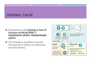 GALACTOSEMIA - ITS NUTRITIONAL MANAGEMENT | PPTX