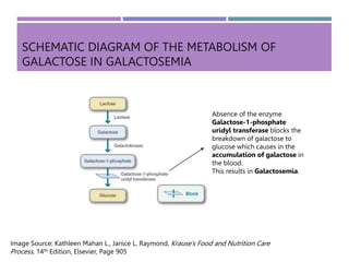 GALACTOSEMIA - ITS NUTRITIONAL MANAGEMENT | PPTX