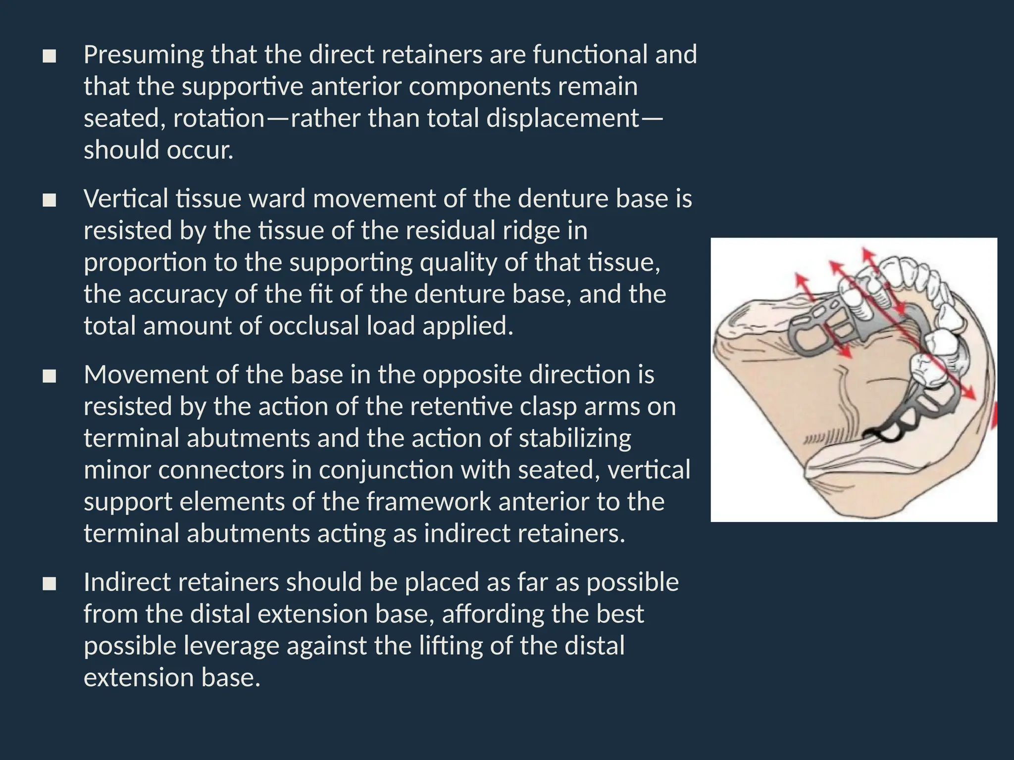 Indirect retainer in removable partial denture | PPTX
