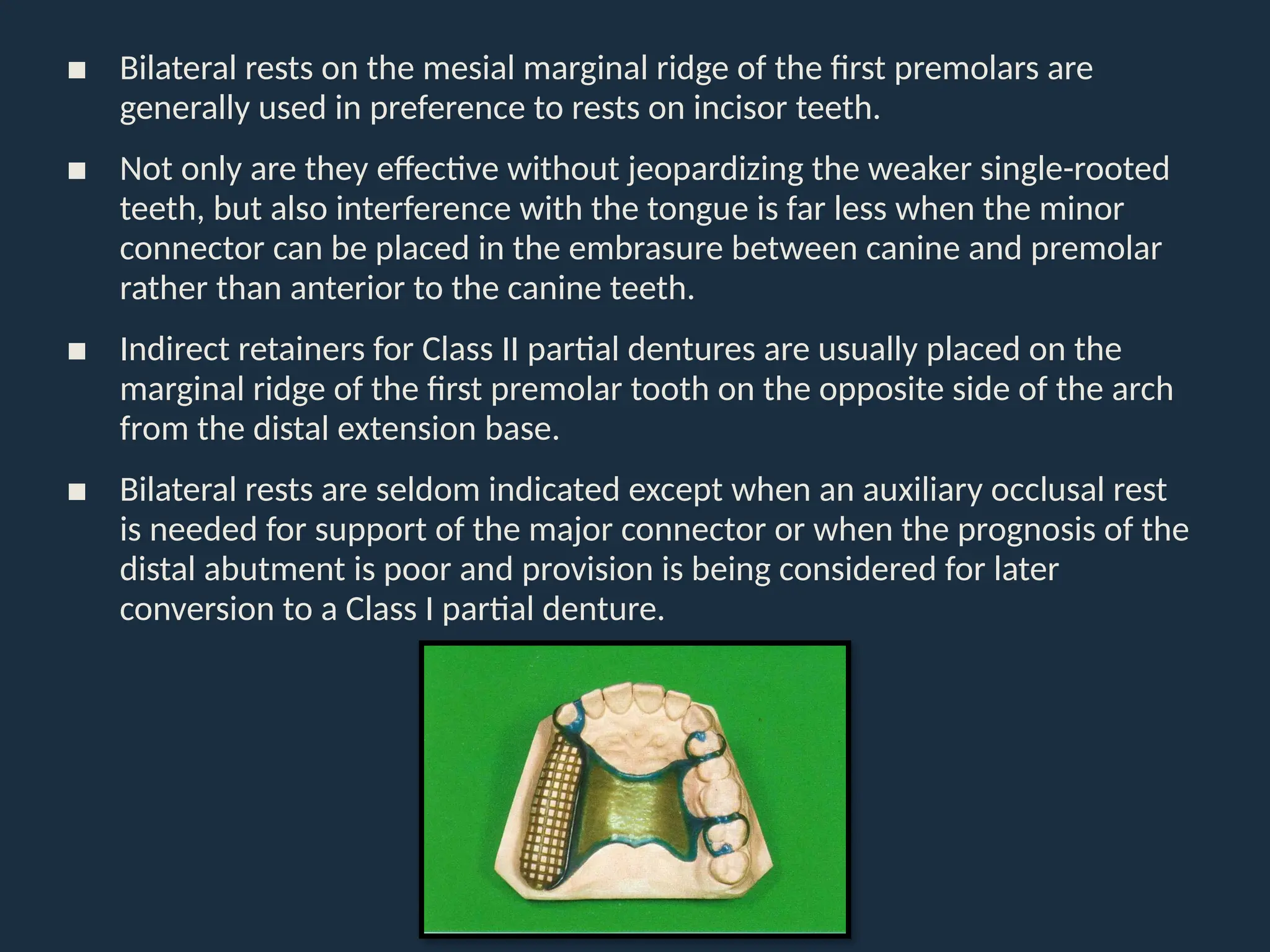Indirect retainer in removable partial denture | PPTX