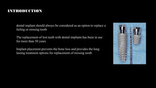 9.Short and Ultra short implants auto.pptx