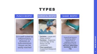 Skin Biopsy in Dermatology | PPTX
