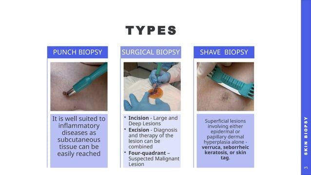Skin Biopsy in Dermatology | PPTX | Skin and Dermatology | Diseases and ...