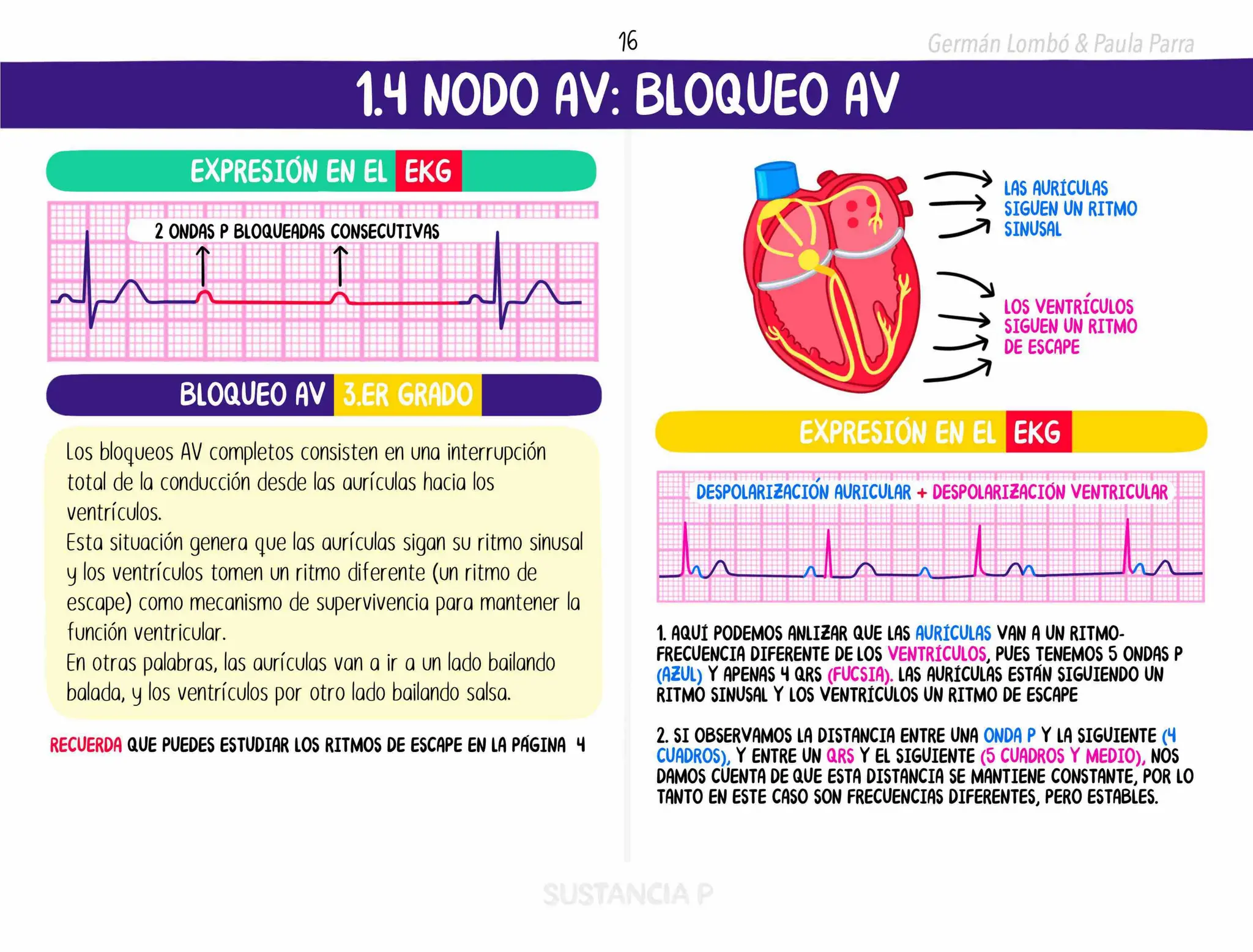 EKG Patológico y contenido básico del electrocardiograma | PPT