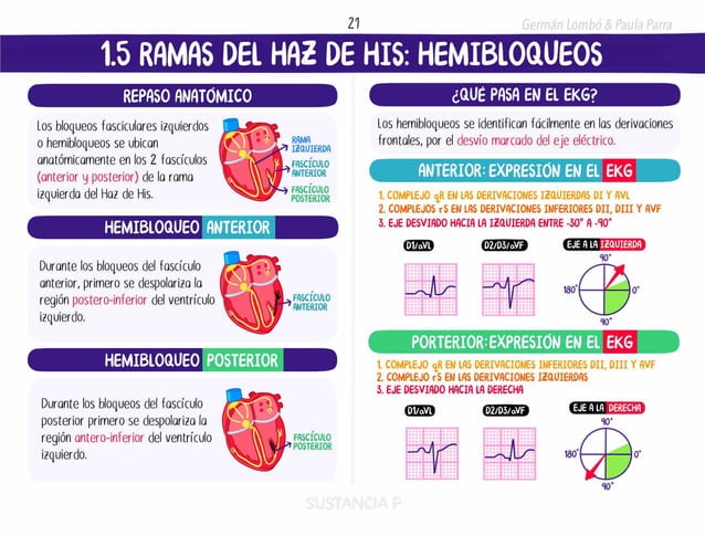 EKG Patológico y contenido básico del electrocardiograma | PPT