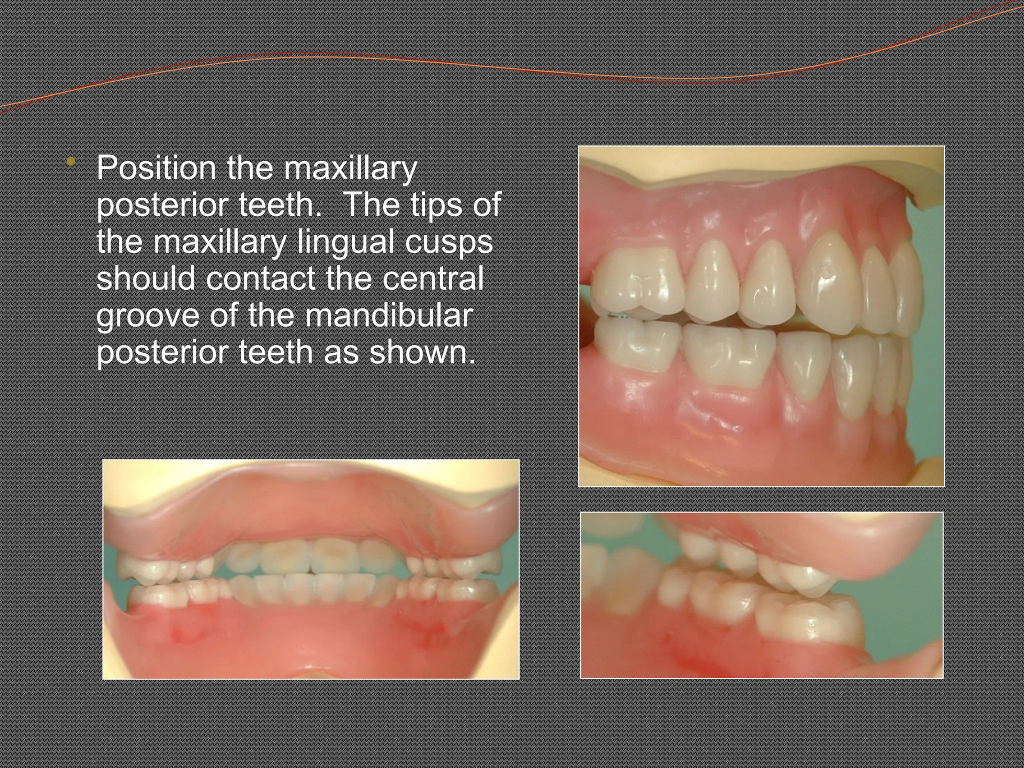 Setting posterior teeth .complete denture | PPTX