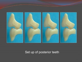 Setting posterior teeth .complete denture | PPTX