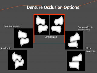 Setting posterior teeth .complete denture | PPTX