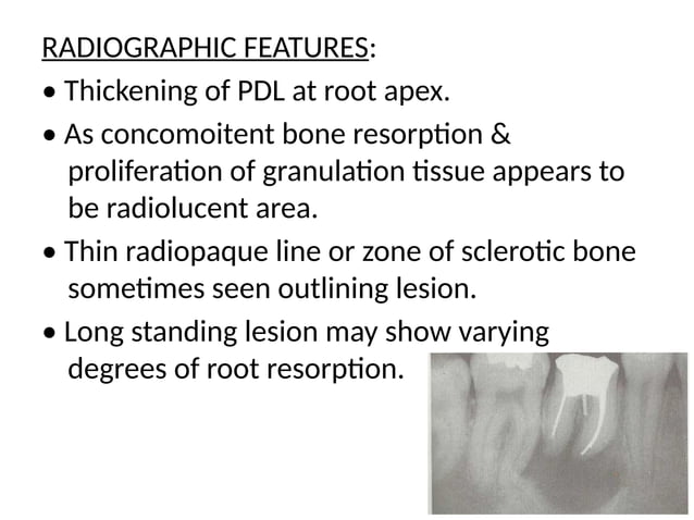 9.PULP & PERIAPICAL DISEASES.ppt -a presentationtx | PPT