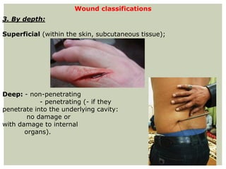 Wounds. wound process. Their classification, treatment, drugs. | PPT