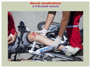Wounds. wound process. Their classification, treatment, drugs. | PDF