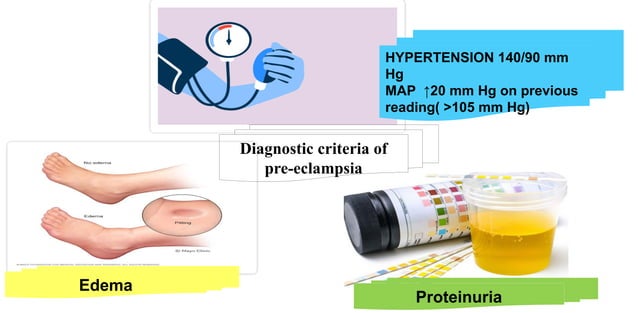 9.PRE-ECLAMPSIA in obstetrics and gynecological nursing | PPT