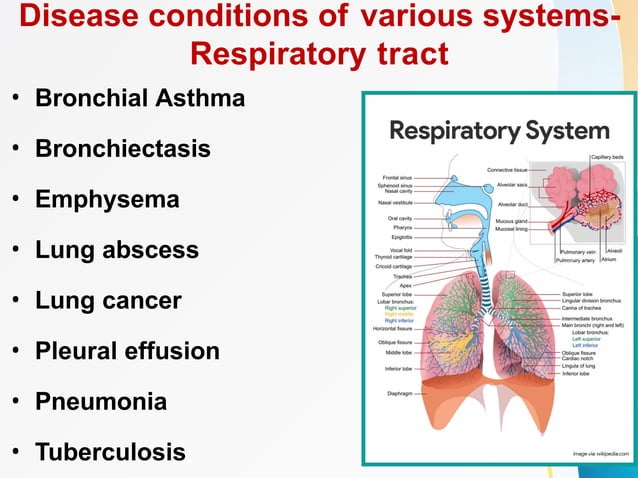 9. Respirtatory System Disease conditions of various systems ...