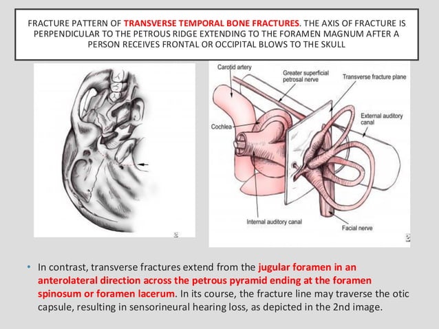 9. ENT Emergencies. Ear emergency, Nose emergency, Throat emergency | PDF