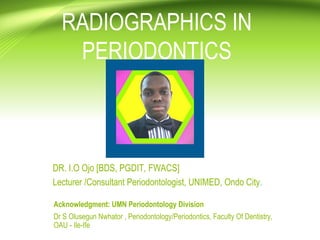 9. Module 2_Lecture 4_ Radiological periodontal diagnosis.ppt