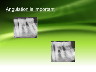 9. Module 2_Lecture 4_ Radiological periodontal diagnosis.ppt