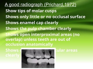 9. Module 2_Lecture 4_ Radiological periodontal diagnosis.ppt