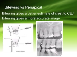 9. Module 2_Lecture 4_ Radiological periodontal diagnosis.ppt