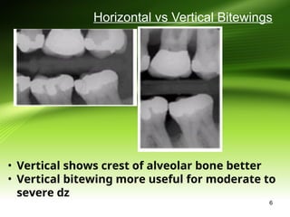 9. Module 2_Lecture 4_ Radiological periodontal diagnosis.ppt