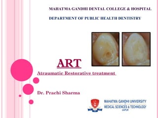 9. Atraumatic Restorative Treatment (2).ppt