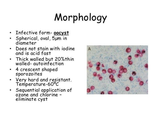 9. Cryptosporidium.pptx microbiology ppt | PPTX