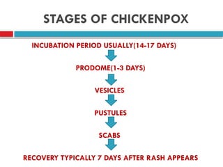 Chickenpox for health sciences students class | PPTX