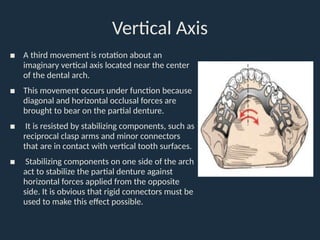 9. Indirect Retainers in removable partial denture | PPTX