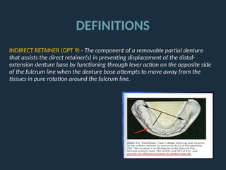 9. Indirect Retainers in removable partial denture | PPTX