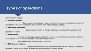 9. THORACIC SURGERY ( VASCULAR SURGERY) PART 3..pptx