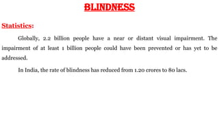 Blindness- UNIT 5 Community Health Nursing | PPTX