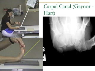 upper limb anatomy and radiological master in upper limb | PPT