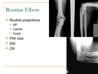 upper limb anatomy and radiological master in upper limb | PPT