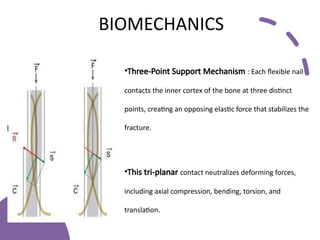 Titanium elastic nailing system overview | PPTX