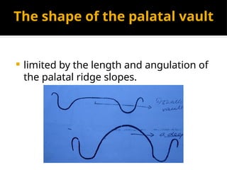9. stability in complete denture.pptx