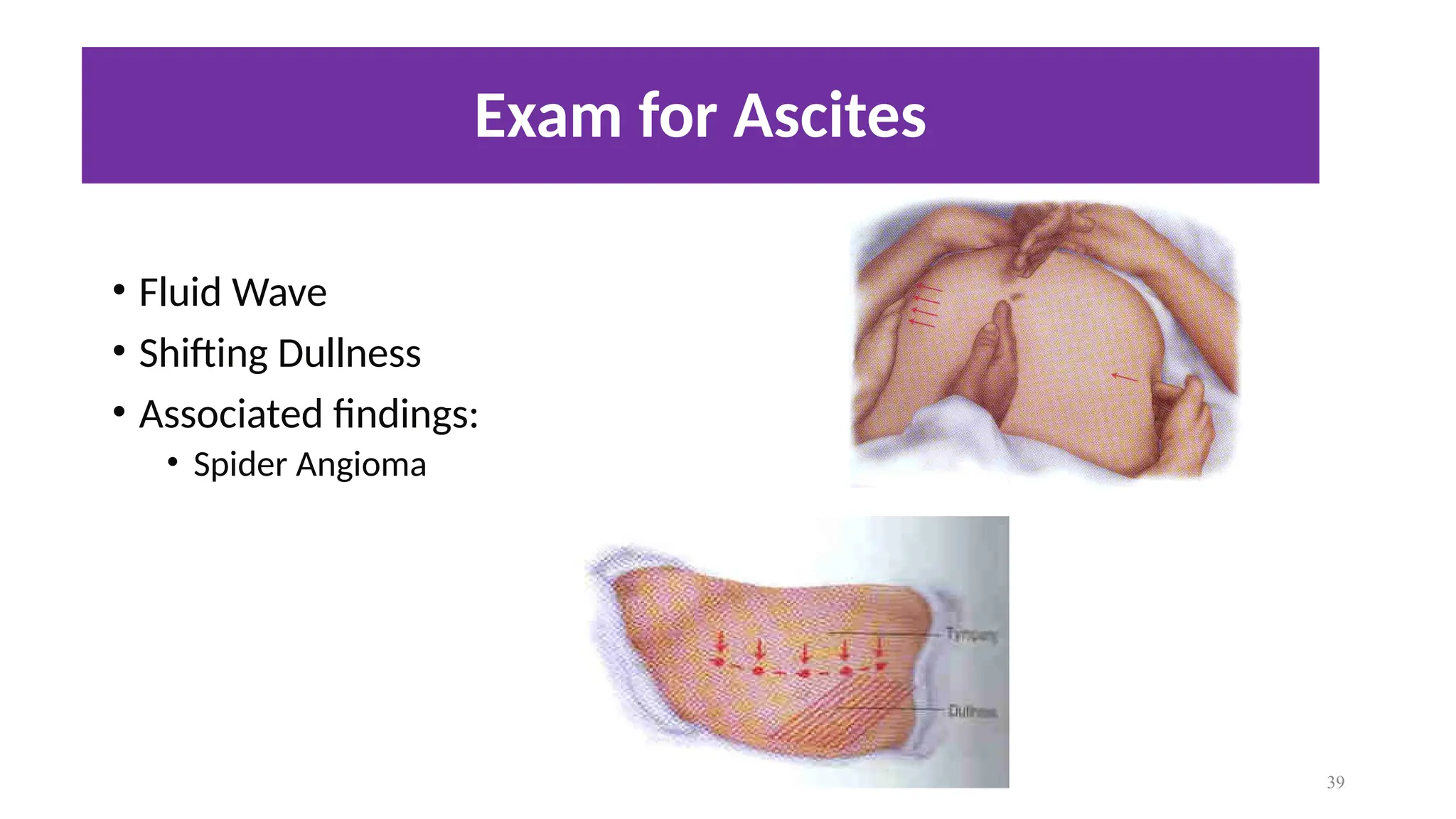 9- abdomen_assesssment and physical exam for adults | PPT