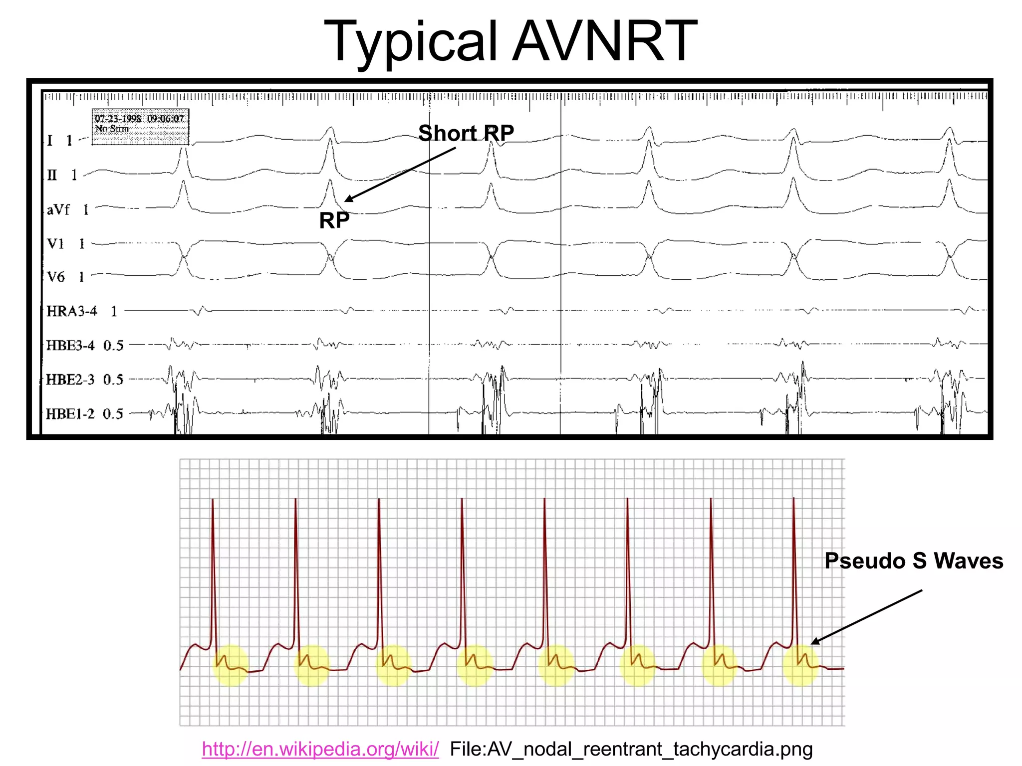 9.avnrt chang sl-0324-2 | PDF