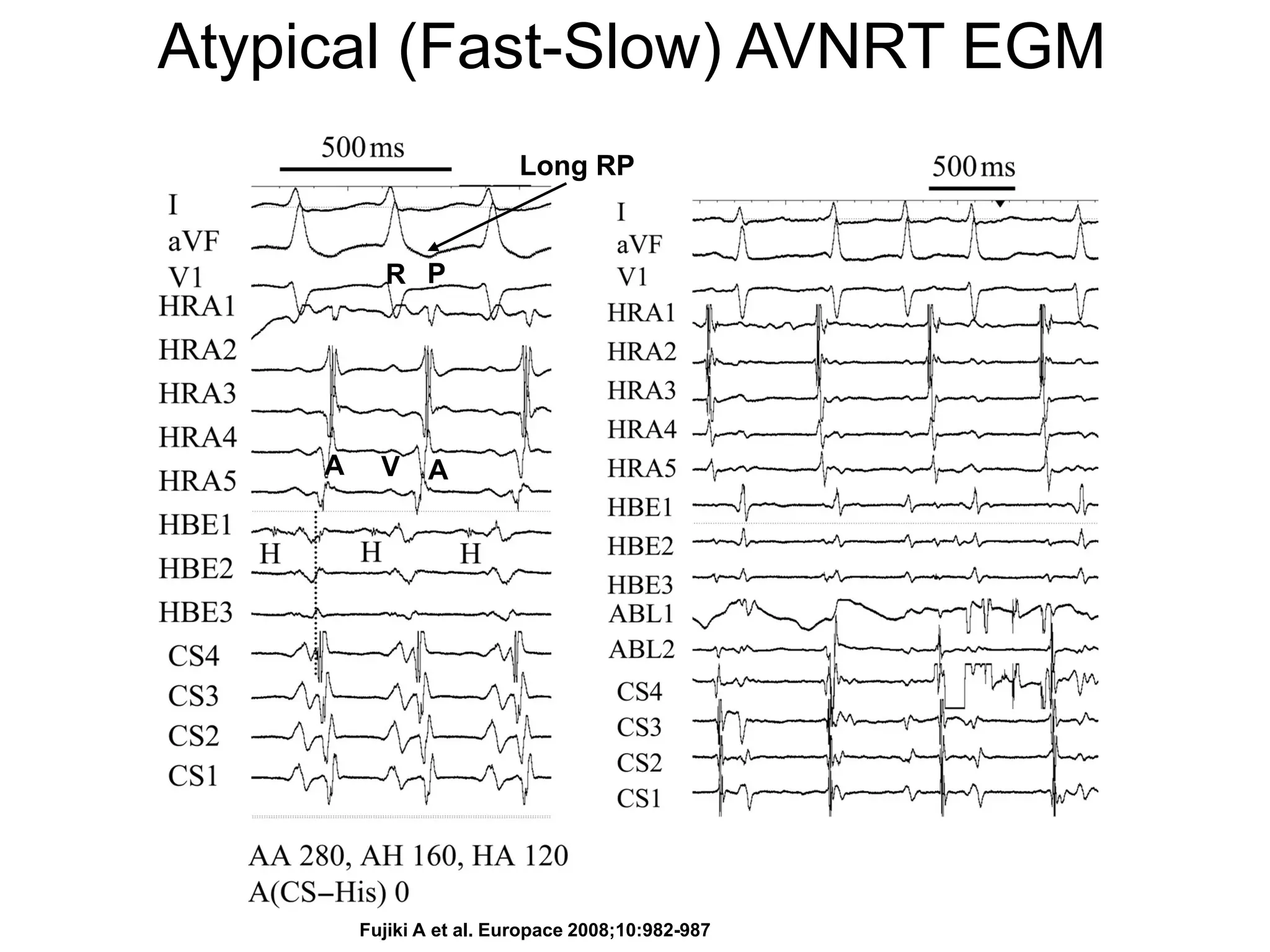 9.avnrt chang sl-0324-2 | PDF