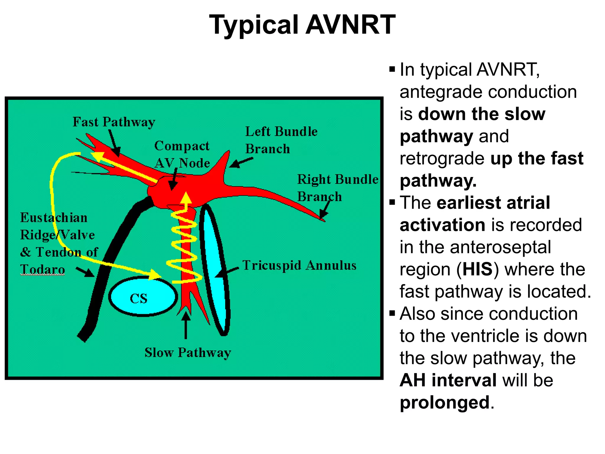 9.avnrt chang sl-0324-2 | PDF