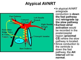9.avnrt chang sl-0324-2 | PDF