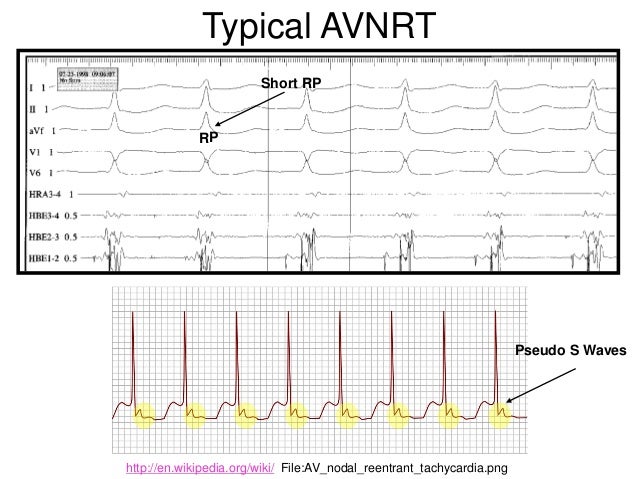 9.avnrt chang sl-0324-2