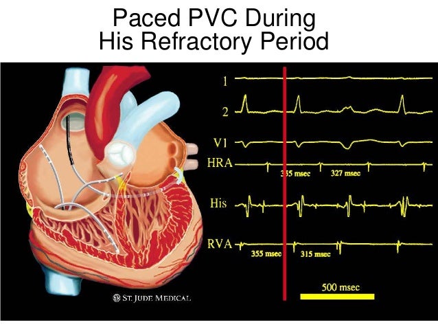 9.avnrt chang sl-0324-2