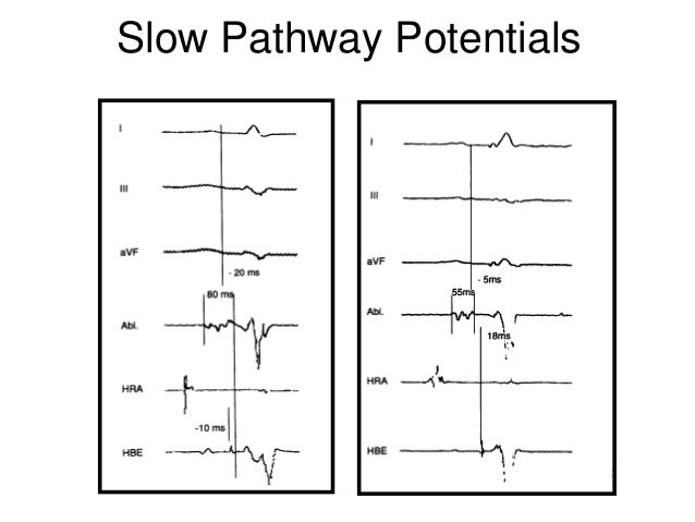 9.avnrt chang sl-0324-2
