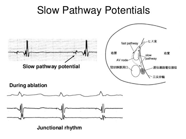 9.avnrt chang sl-0324-2