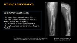 9-B- RAMIRO- FRACTURAS CONCEPTOS, TIPOS, CLASIFICACIONES, TECNICAS DE ...
