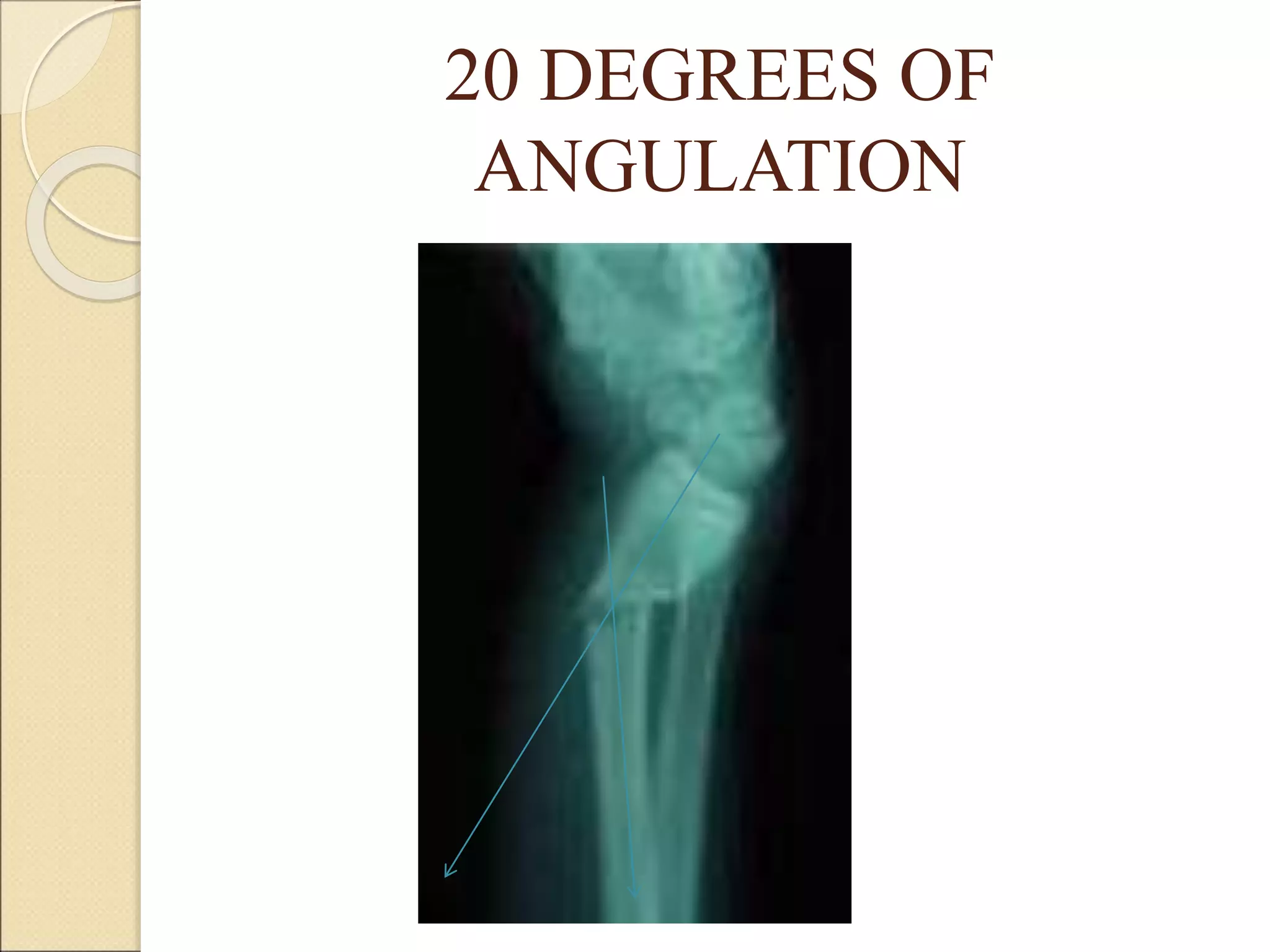 9- BASICS OF ORTHOPEDIC RADIOLOGY.ppt