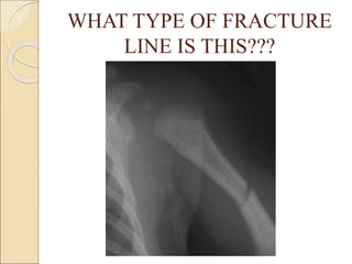 9- BASICS OF ORTHOPEDIC RADIOLOGY.ppt