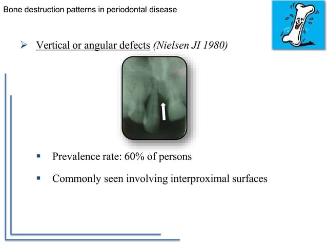 9-bonelosspatterns-read-160503155301.pptx | Bone and Joint Conditions ...