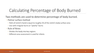 9 burn emergencies | PPT