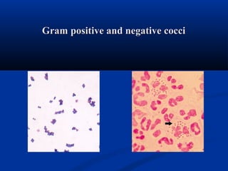 Gram Negative Cocci In Clusters